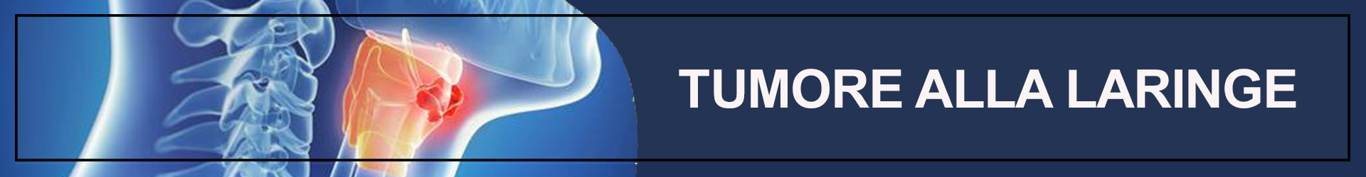 Tumore della laringe: cause e terapia - Avv. Ezio Bonanni